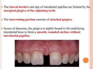 Gingiva (Macroscopic features) | PPTX