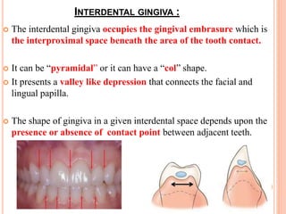 Gingiva (Macroscopic features) | PPT