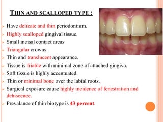 Gingiva (Macroscopic features) | PPT