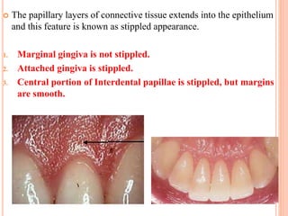 Gingiva (Macroscopic features) | PPT