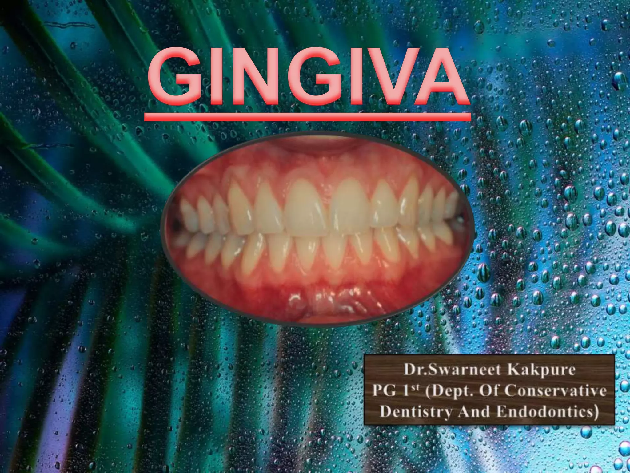Gingiva and its diseases | PPTX