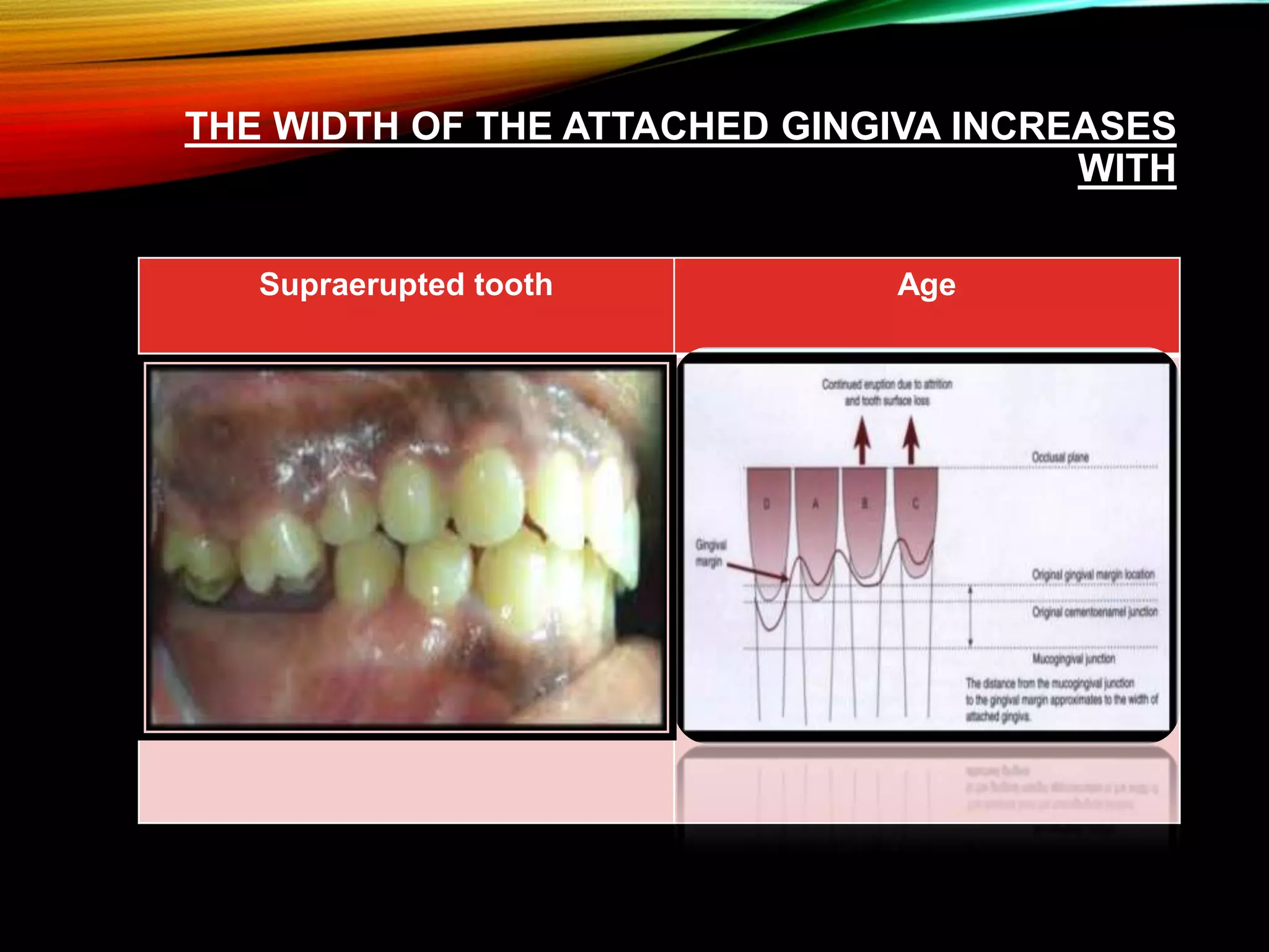 Gingiva and its diseases | PPTX