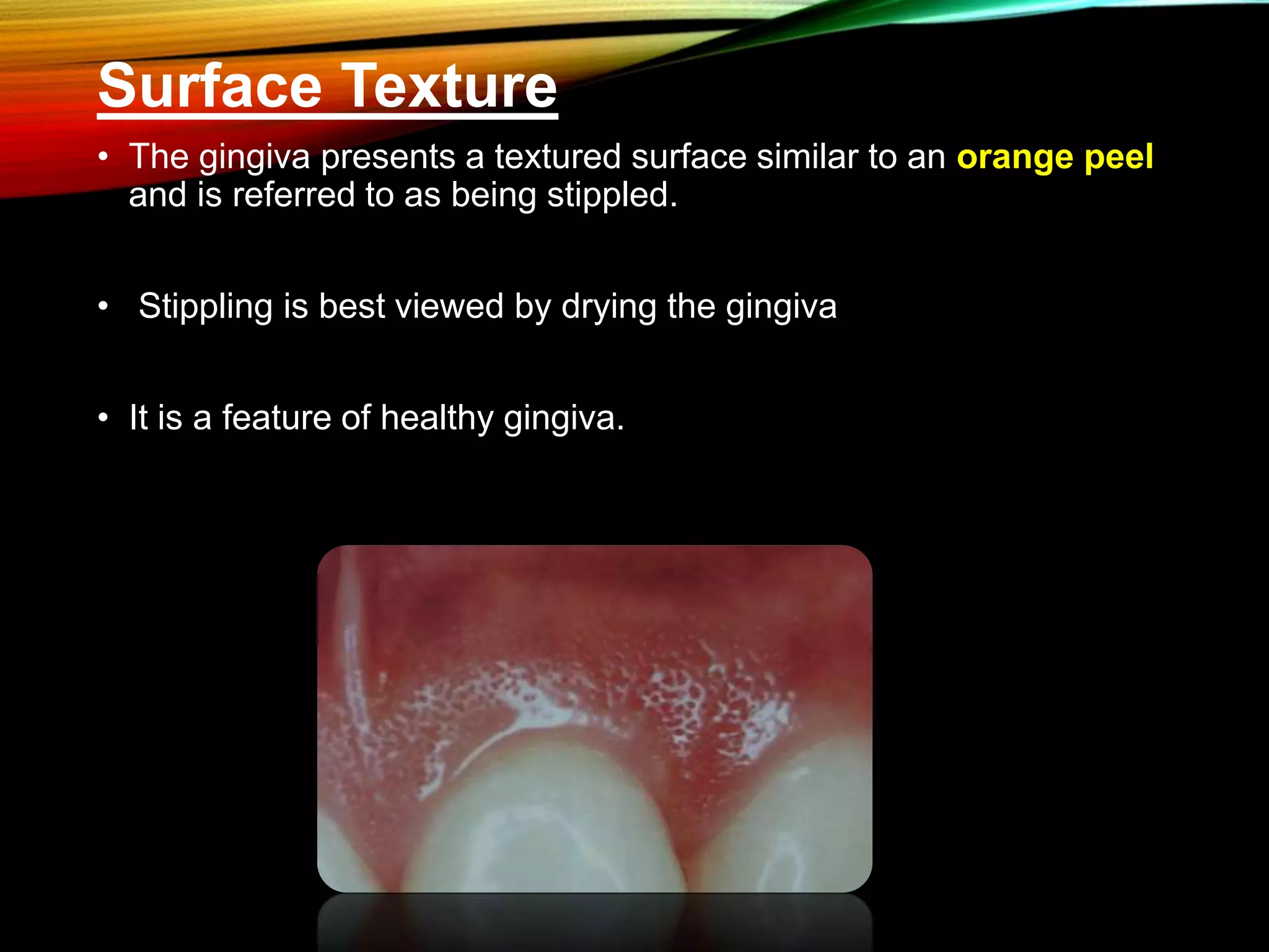 Gingiva and its diseases | PPTX
