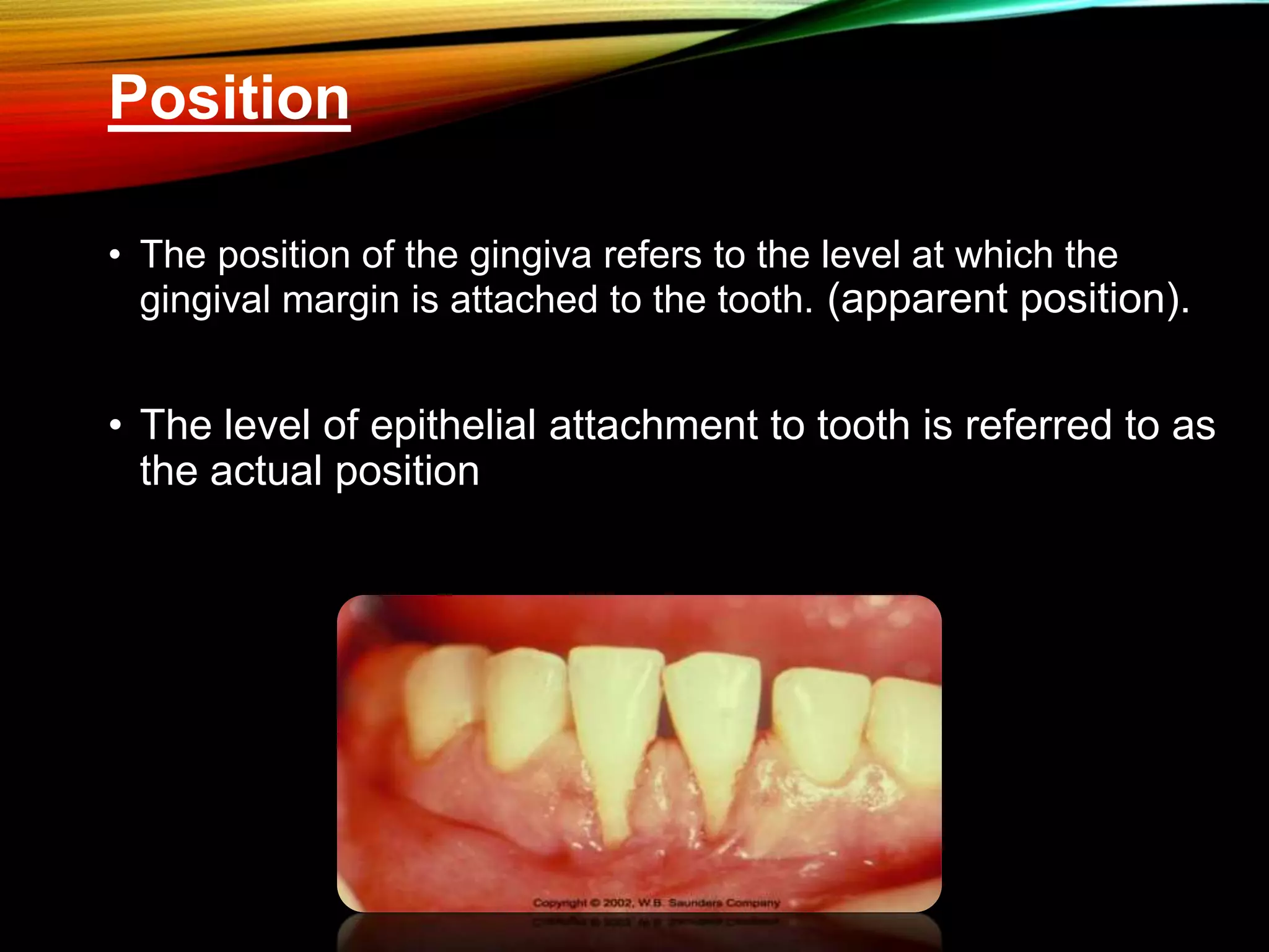 Gingiva and its diseases | PPTX
