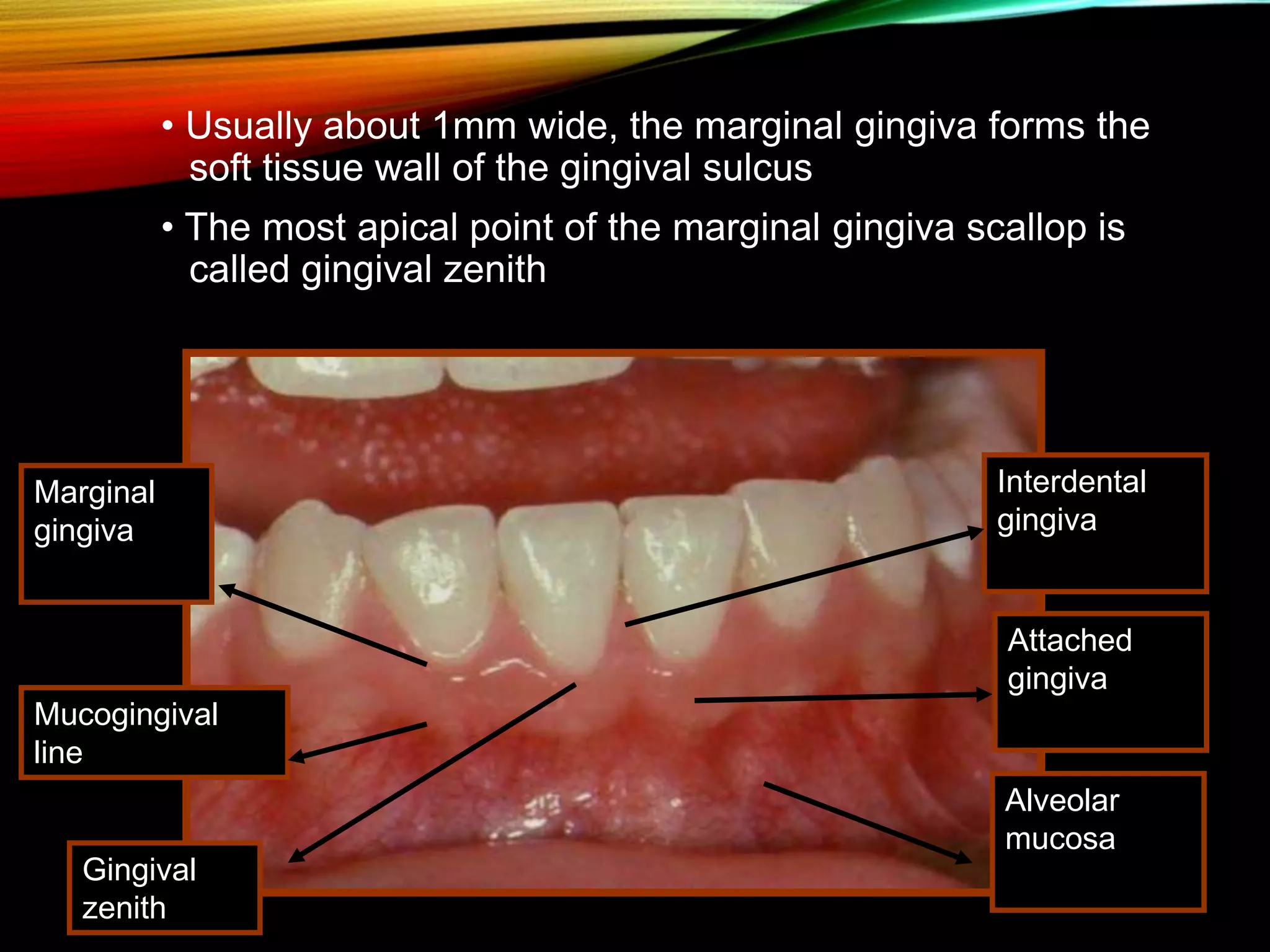 Gingiva and its diseases | PPTX