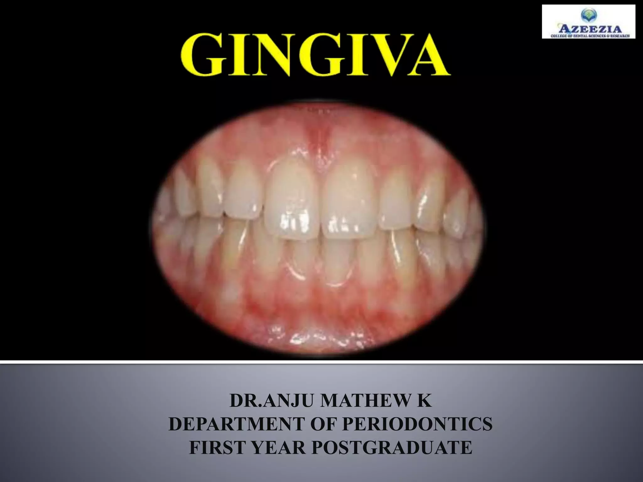 Gingiva | PPTX