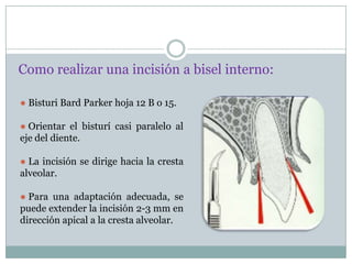 Gingivectomia bisel interno | PPT