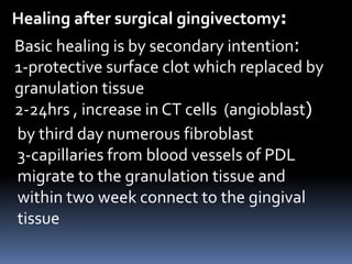 Gingivectomy | PPTX