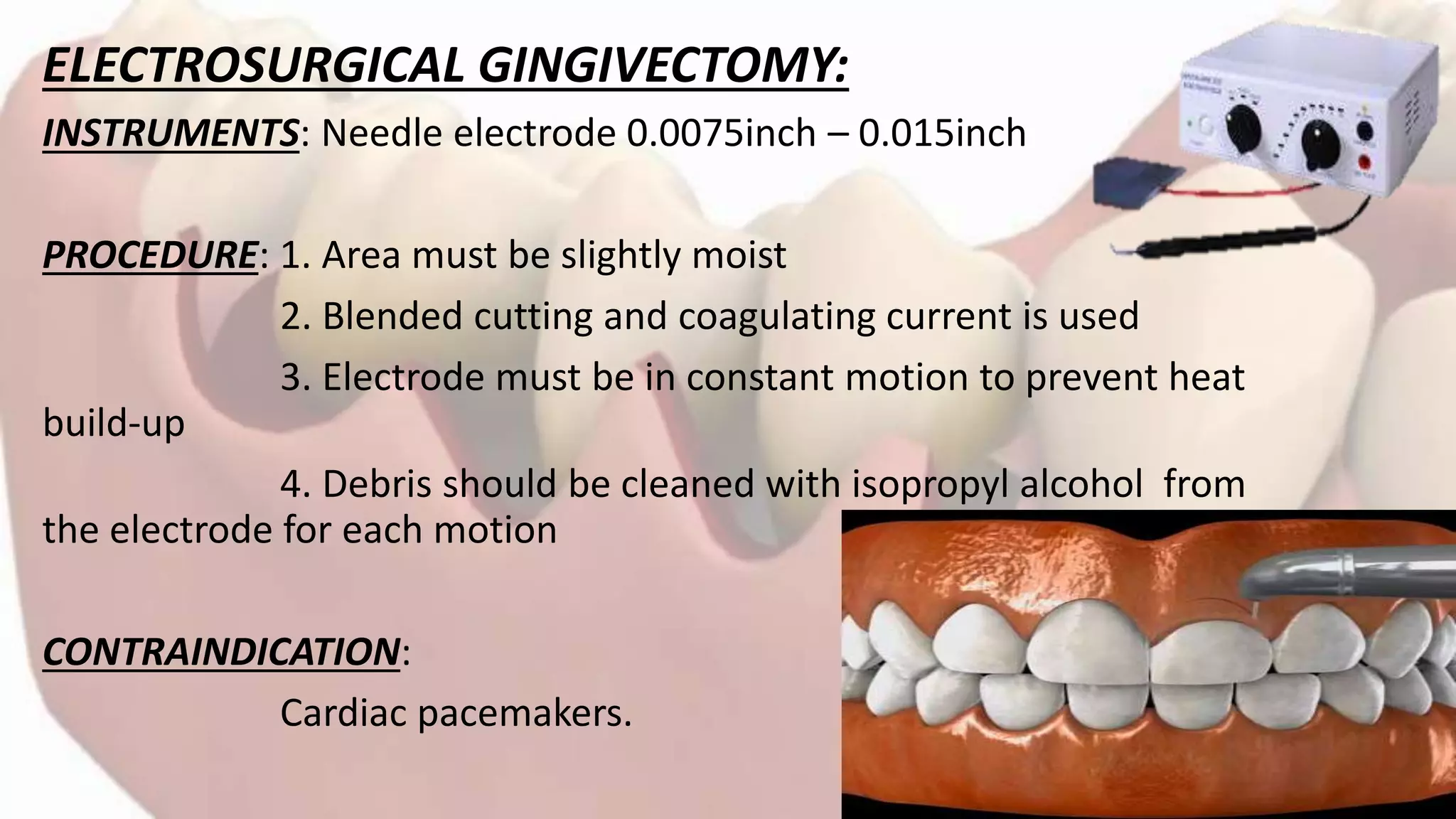 Gingivectomy and Gingivoplasty | PPTX
