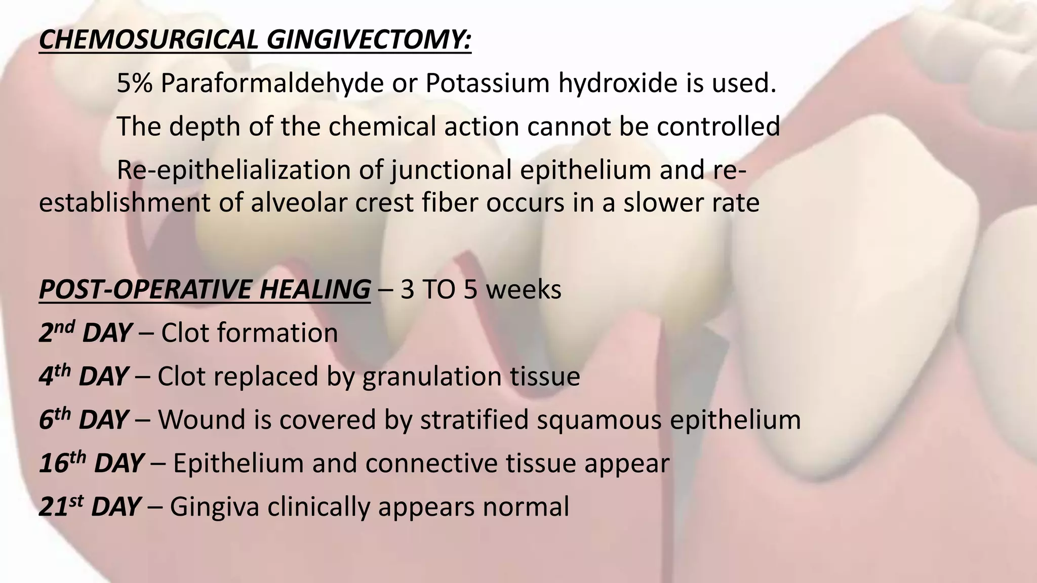 Gingivectomy and Gingivoplasty | PPTX