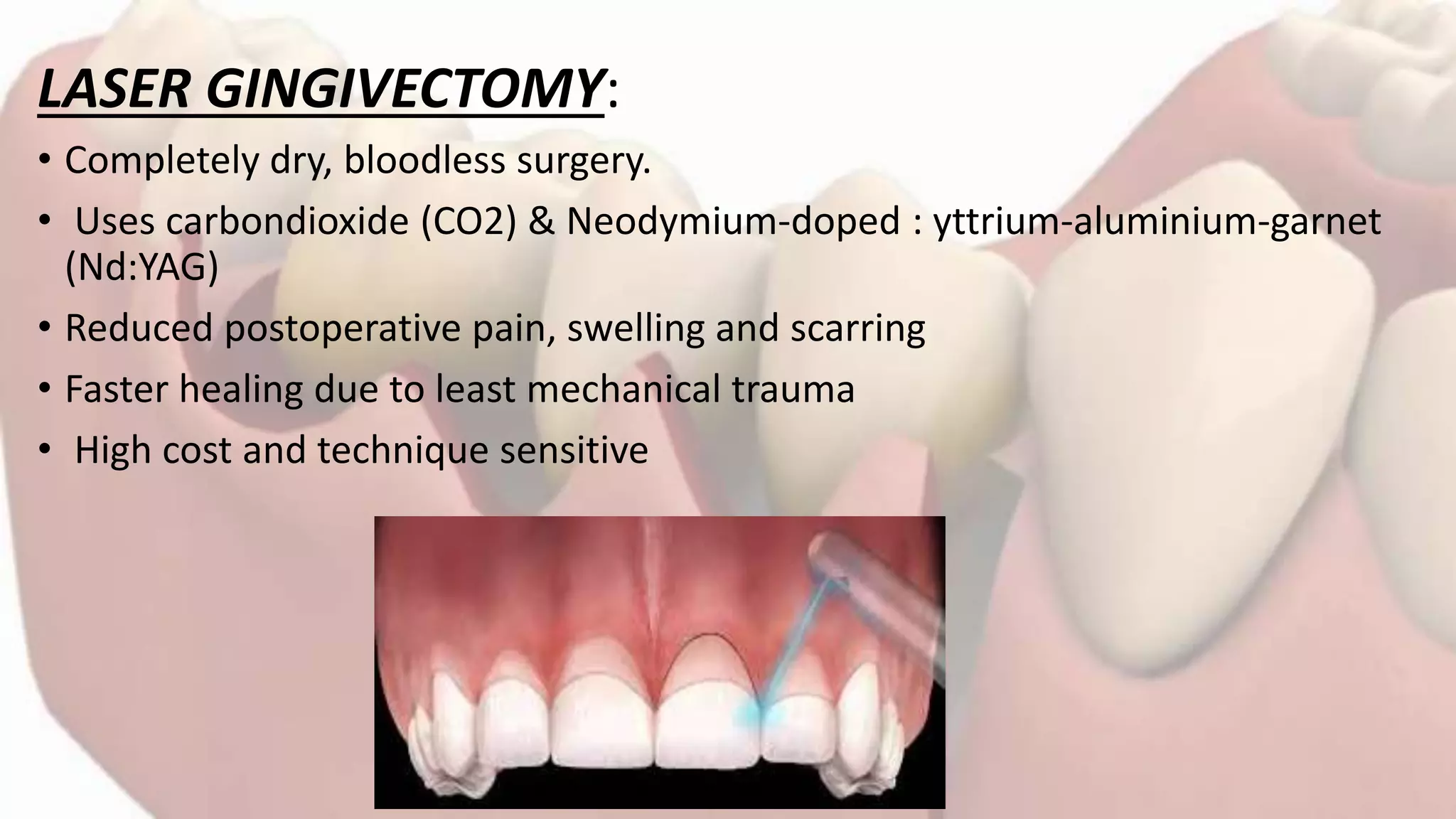 Gingivectomy and Gingivoplasty | PPTX