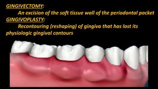 Gingivectomy and Gingivoplasty | PPTX