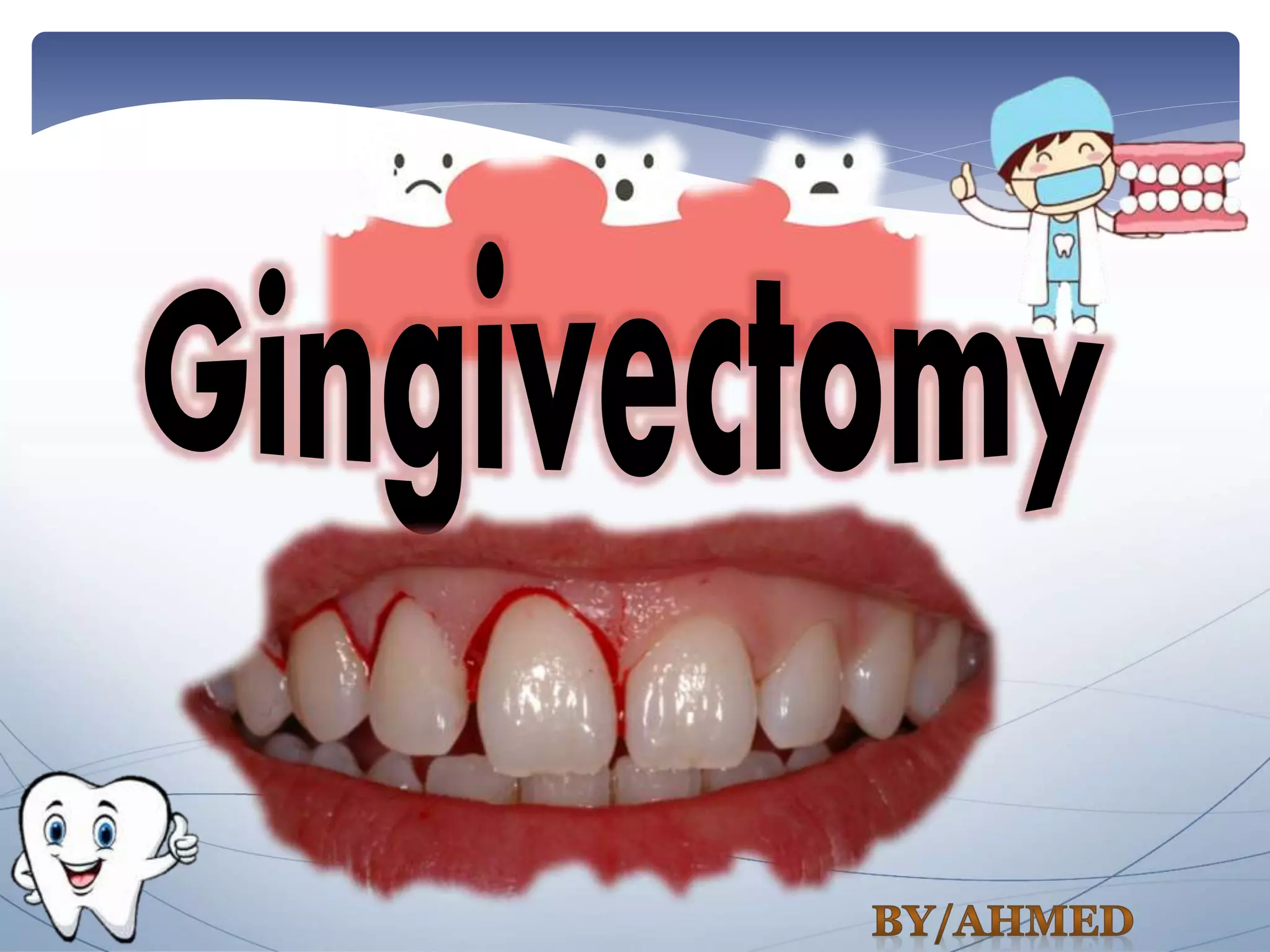Gingivectomy PPTX Gingivectomy PPTX