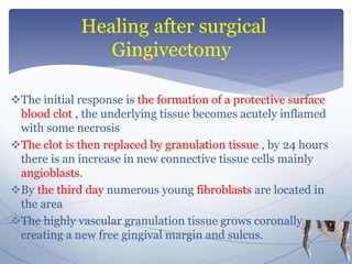 Gingivectomy | PPTX