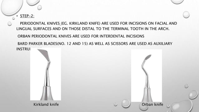 Gingivectomy- Surgical procedure in Periodontics | PPTX