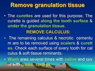 Gingivectomy .. periodontal diseases lect.Asma'a.pptx
