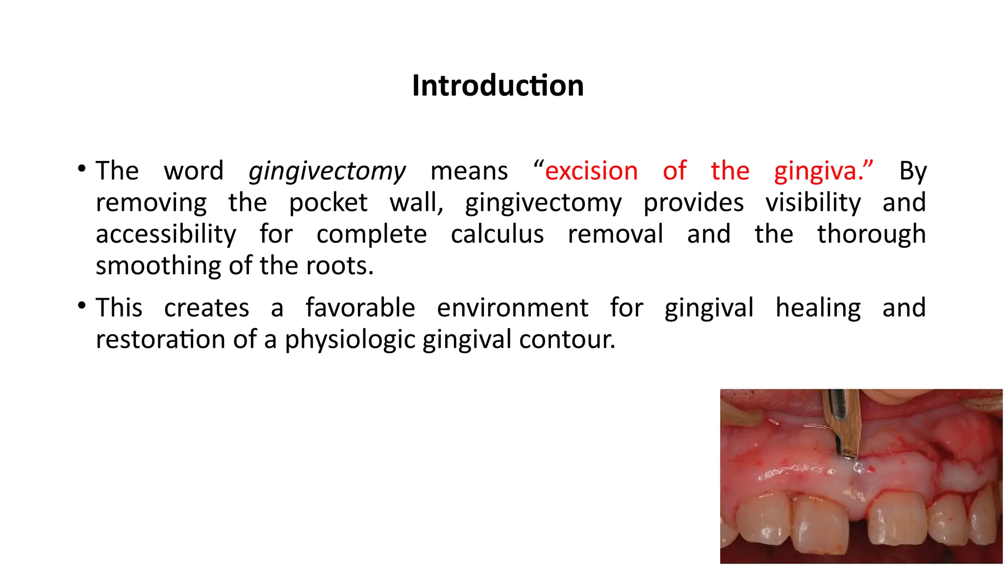 Gingivectomy lecture.pptx in periodontics | PPTX