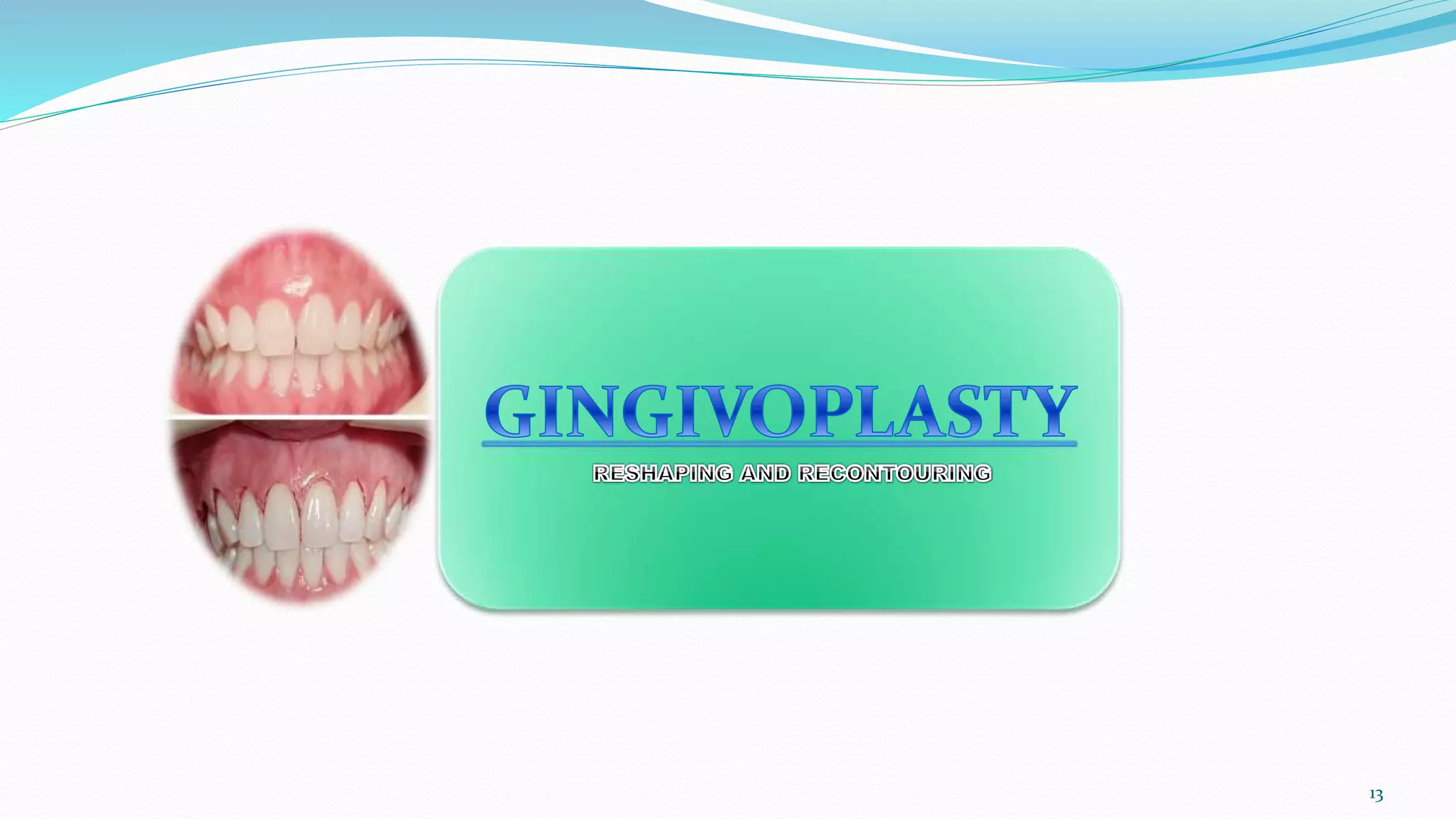 Gingivectomy ppt | PPTX