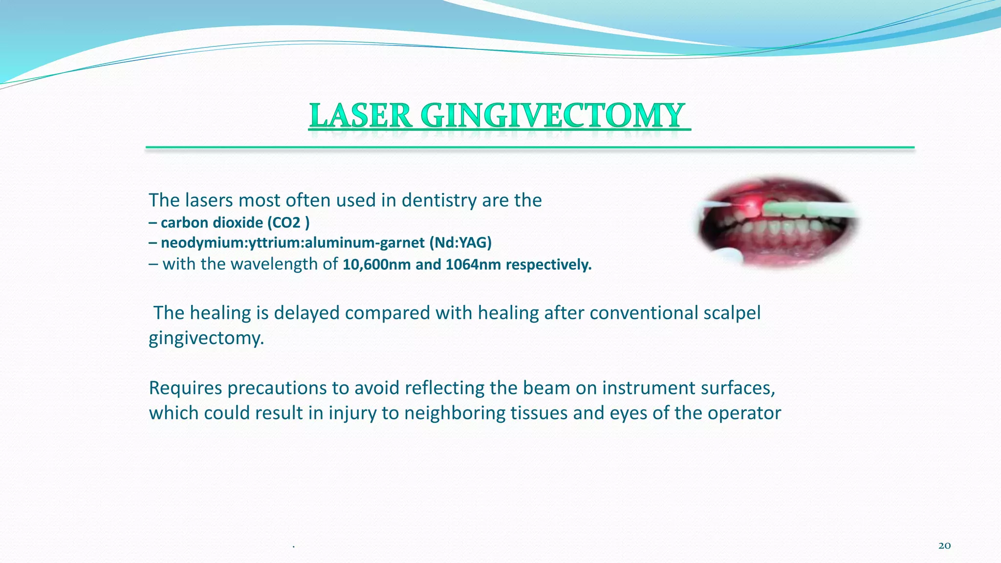 Gingivectomy ppt | PPTX