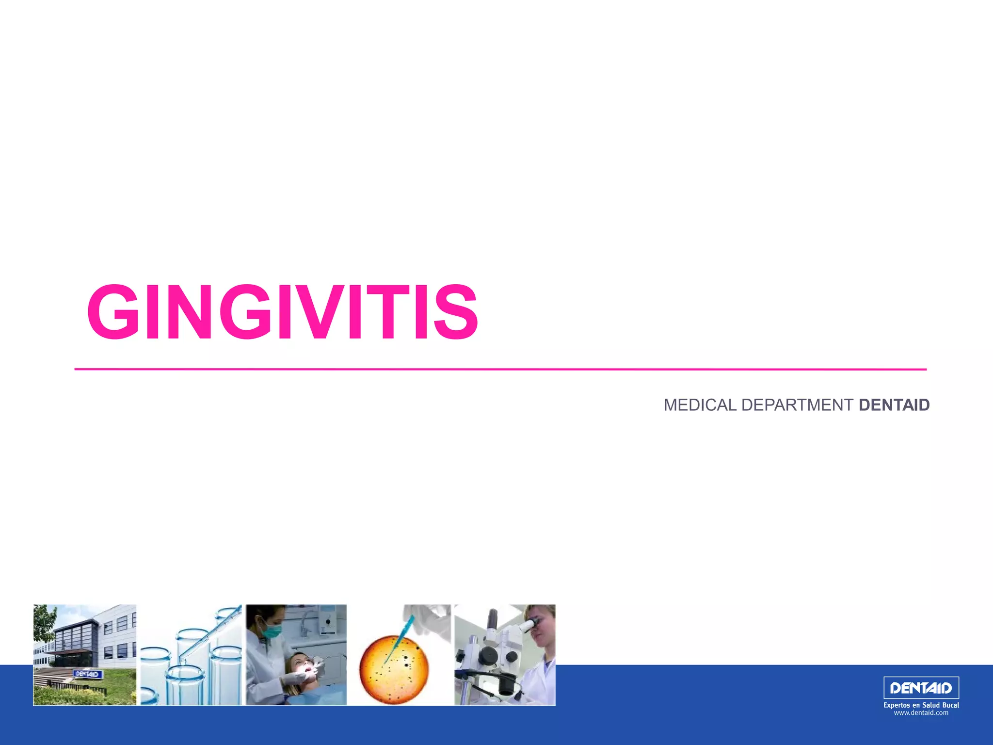 Gingivitis | PPT | Dental Health | Diseases and Conditions