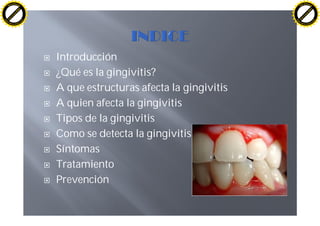 Gingivitis | PDF