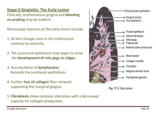 Gingivitis | PDF