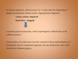 Gingivitis | PPTX