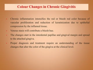 Gingivitis | PPTX