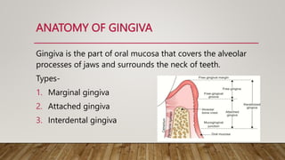 Gingivitis.pptx