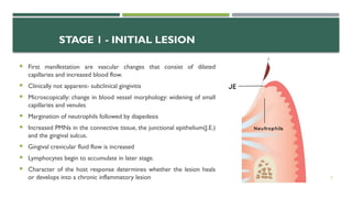 Gingivitis | PPTX