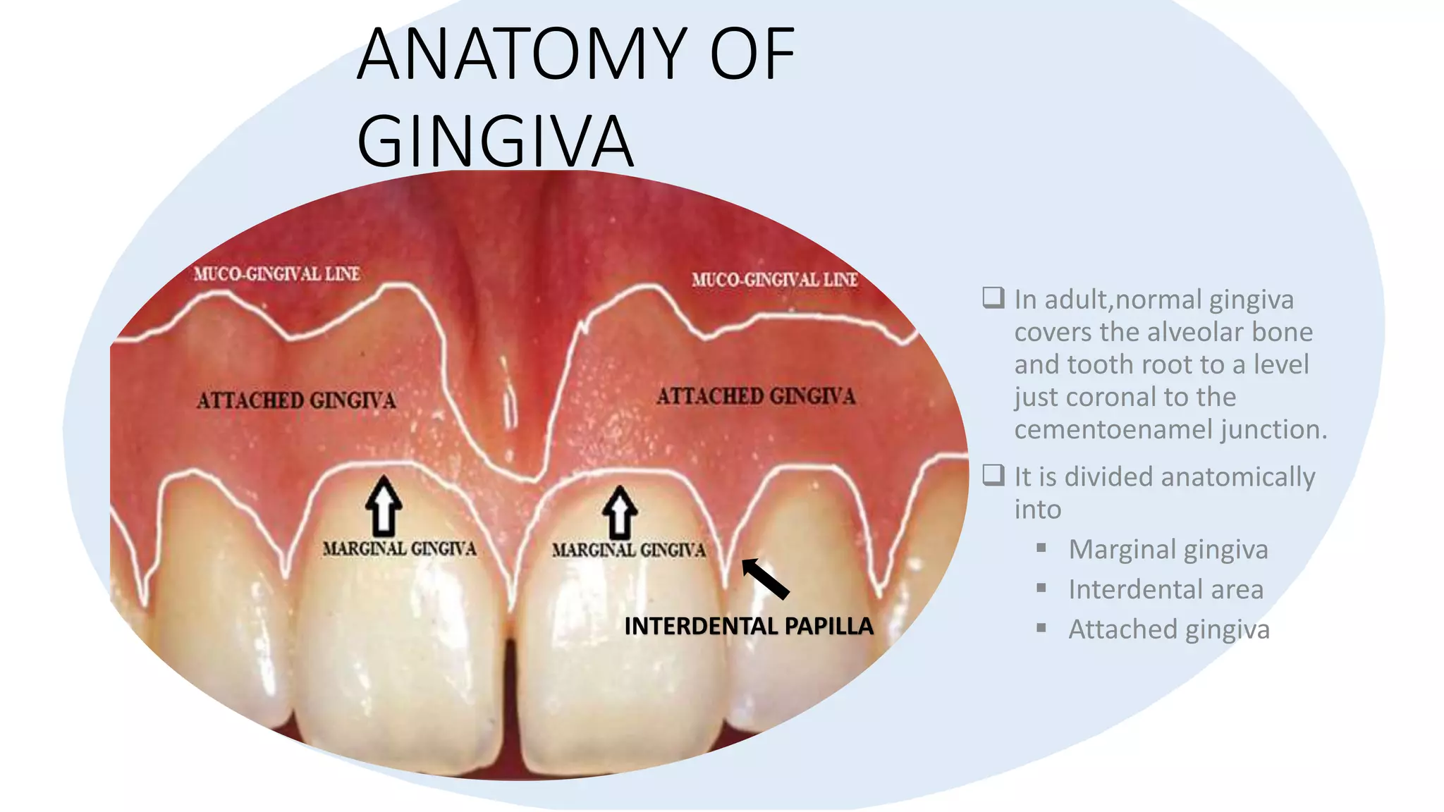 Gingivitis main | PPTX