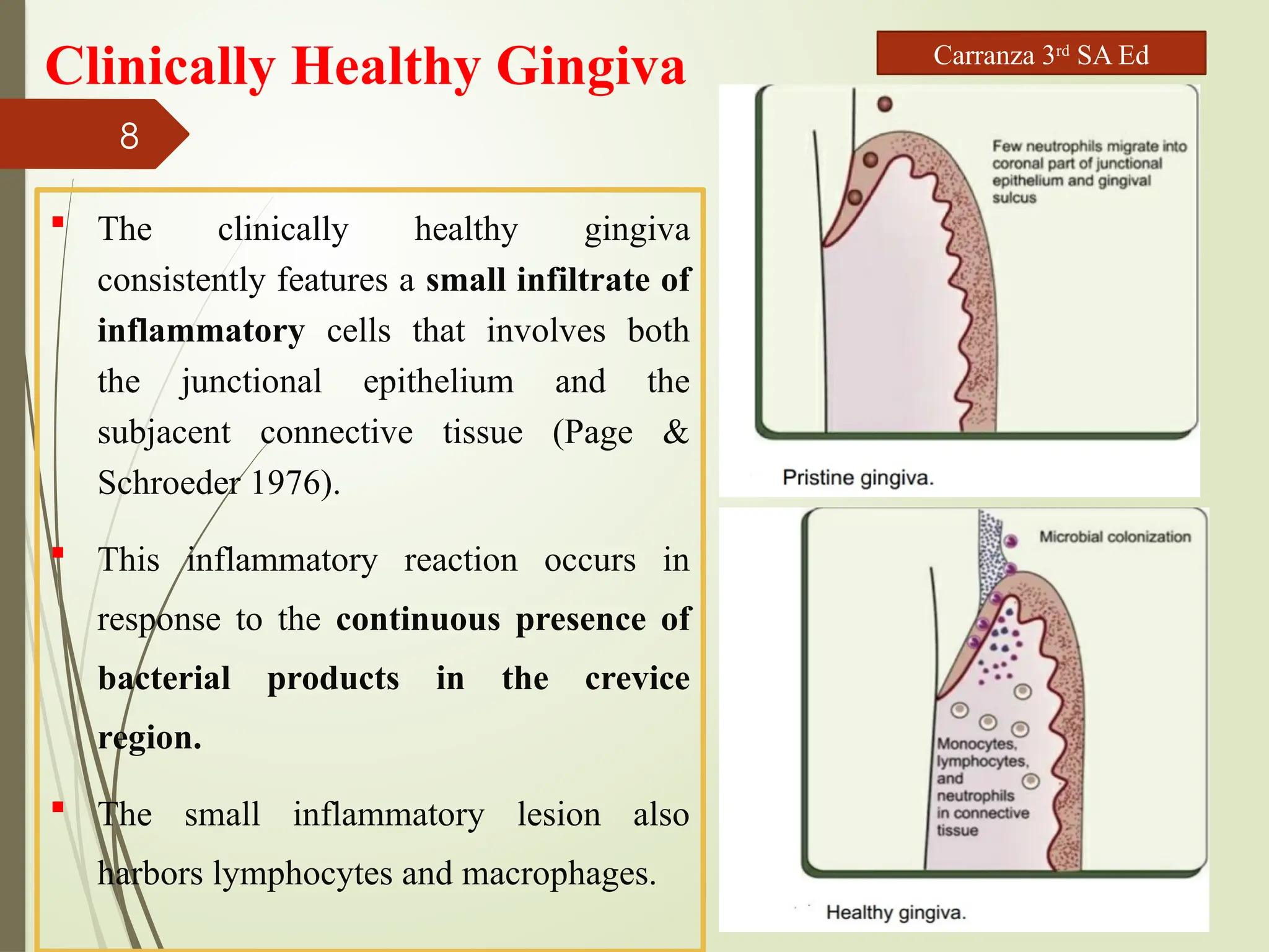 gingivitis- sem 6.pptxNBNBNBNBNNBBNBNBNBNB | PPTX