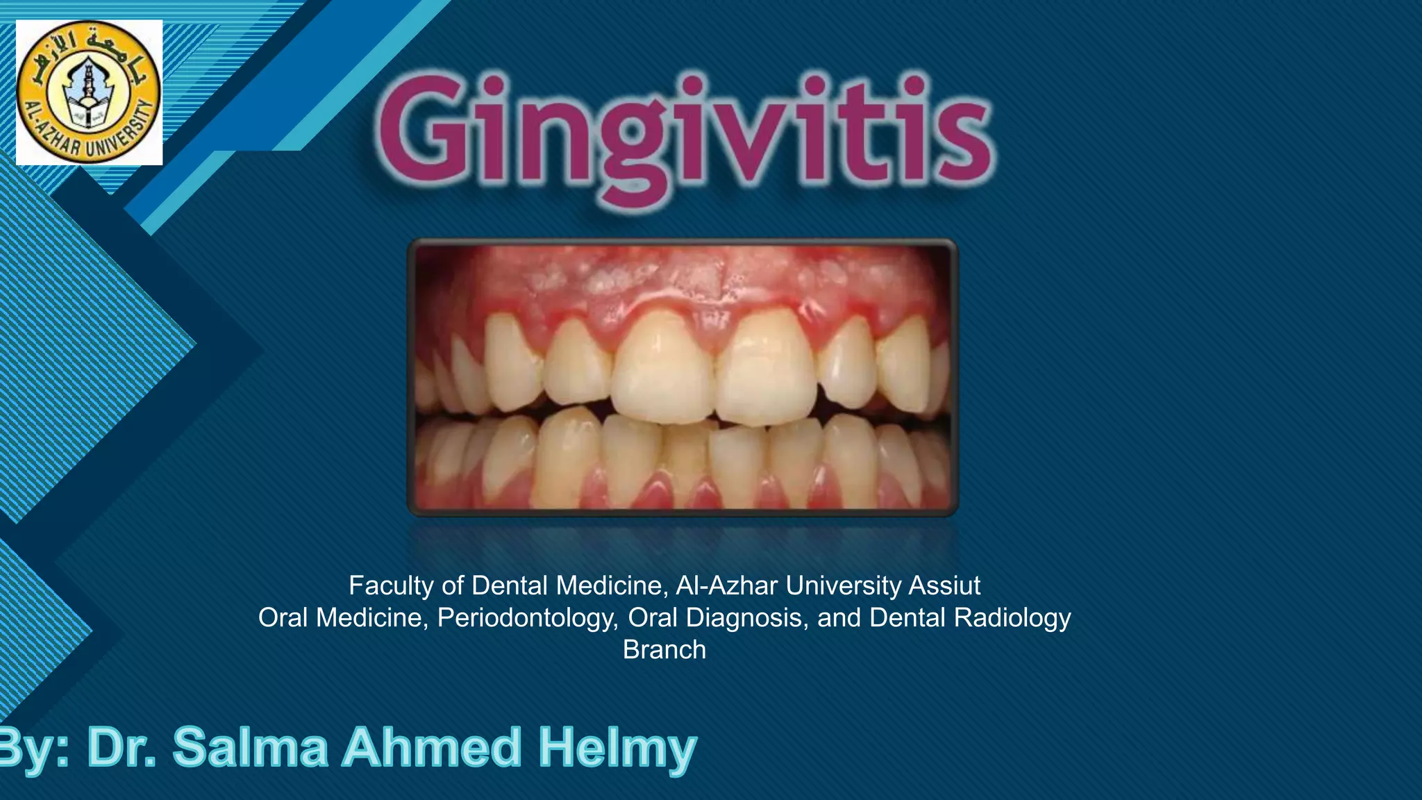 Gingivitis.pptx