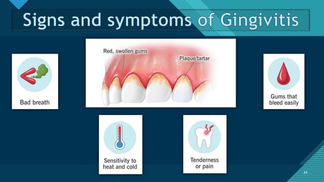 Gingivitis.pptx