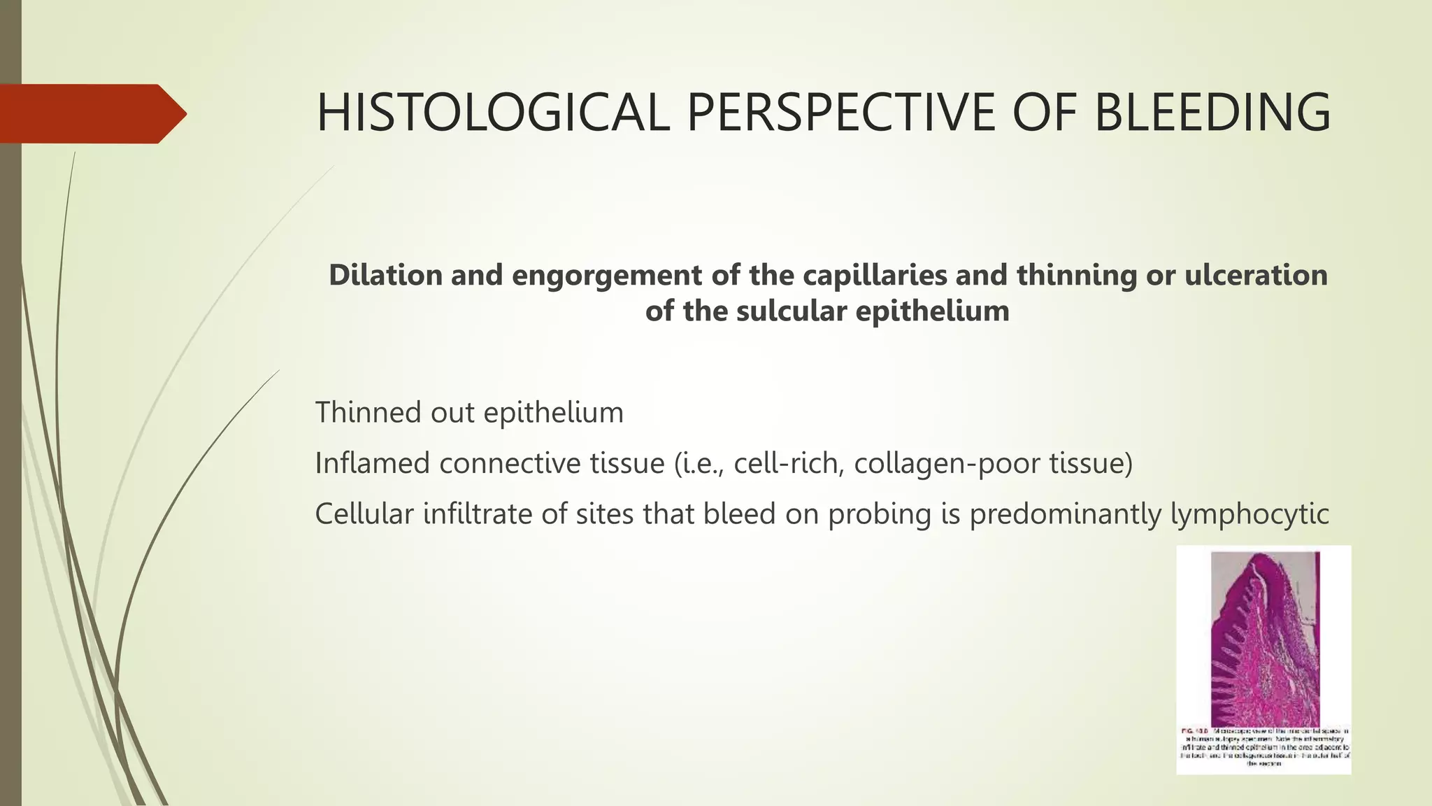 gingivitis and gingival bleeding.pptx