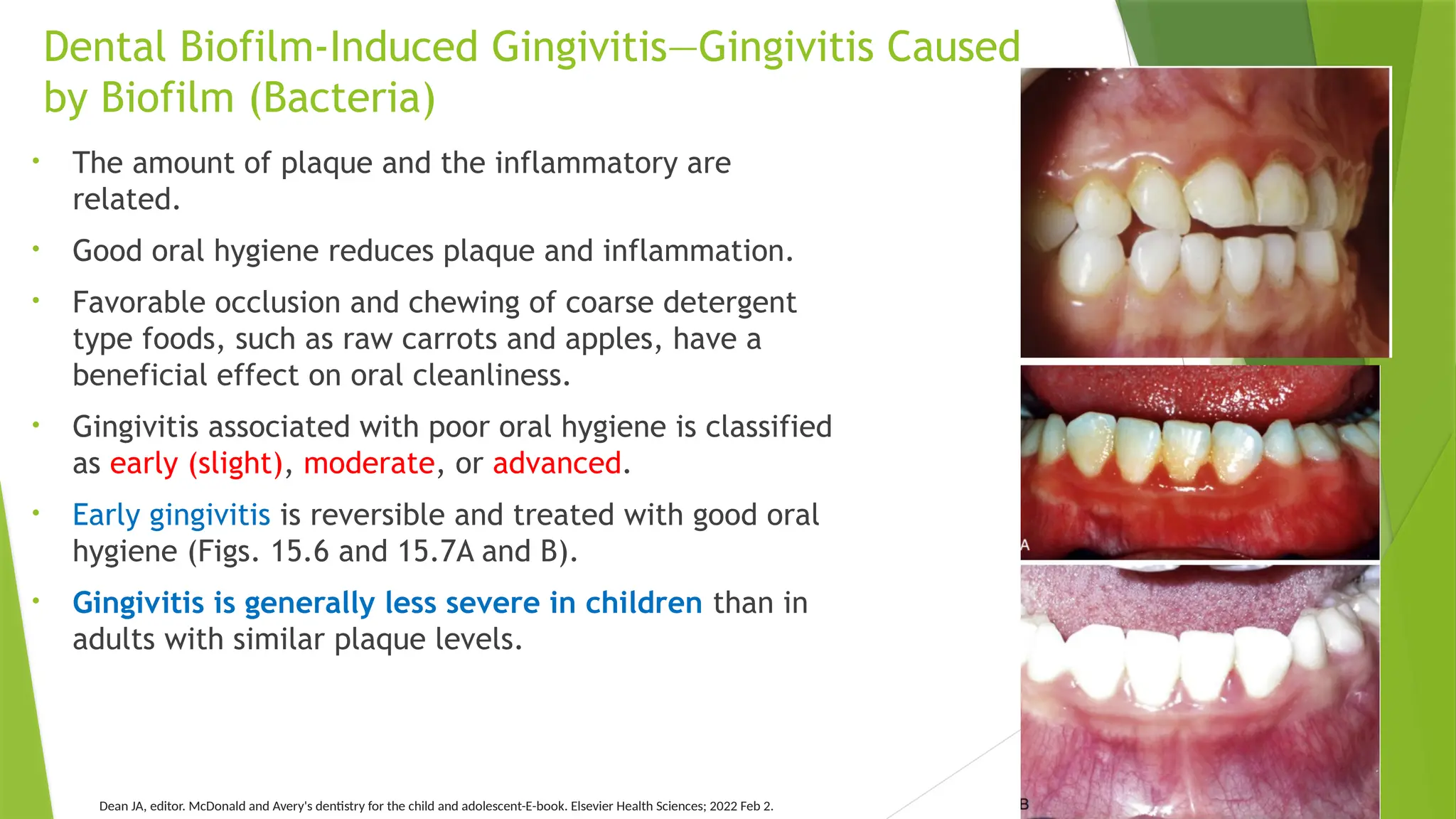 Gingivitis and Periodontal Disease last adjusments.pptx