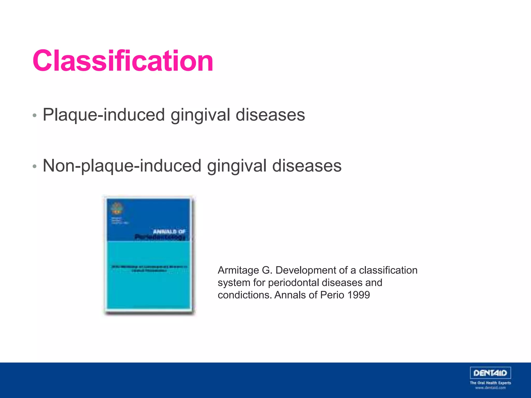 Gingivitis | PPT