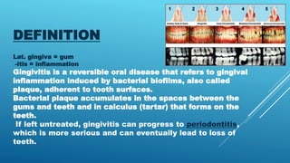Gingivitis presentation | PPTX