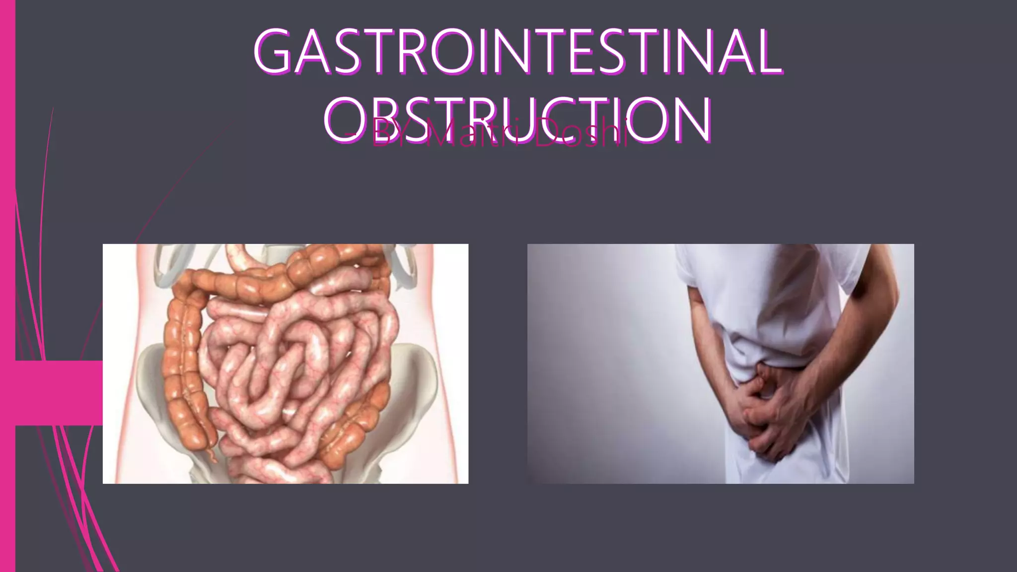 Gastrointestinal obstruction | PPT