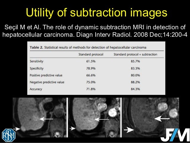 Giovanni Morana, diagnostic imaging of small hcc in liver cirrhosis,