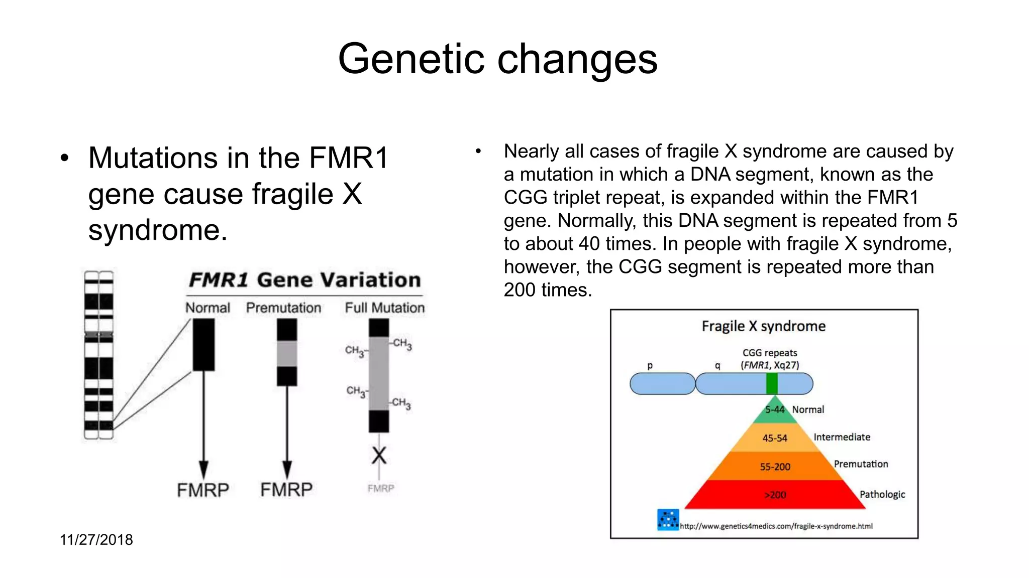Fragile x syndrome | PPTX
