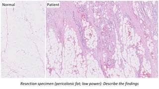 GI Path SG 2022 (student prep slides).pptx