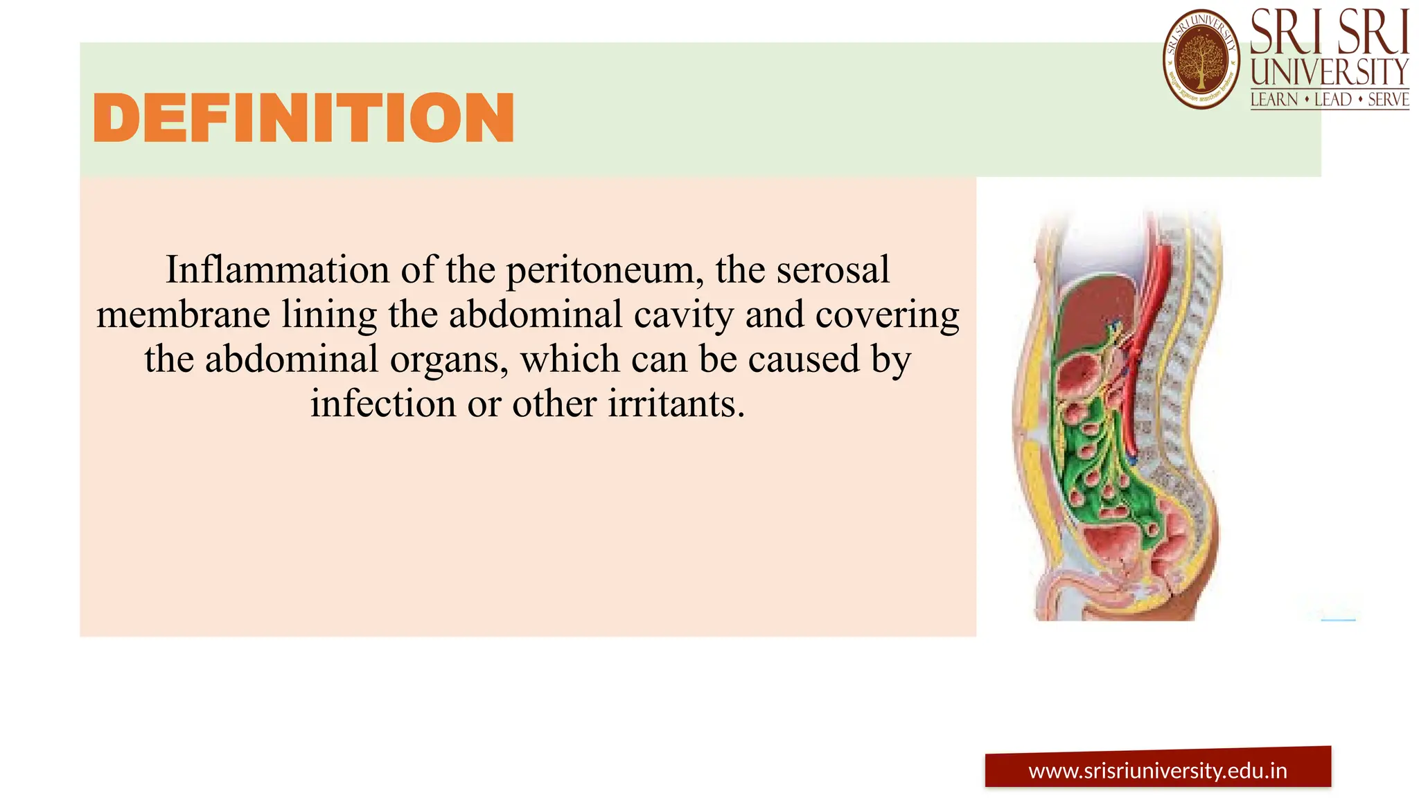 GASTROINTESTINAL PERFORATION & PERITONITIS.pptx