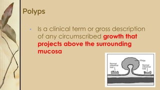 Gi polyps | PDF
