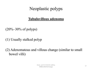 GI polyps.pptx
