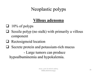 GI polyps.pptx