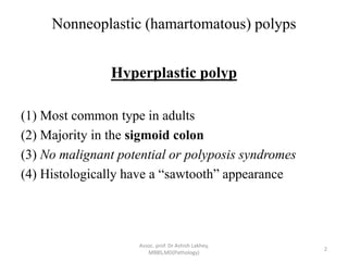 GI polyps.pptx