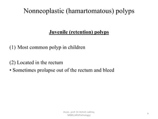 GI polyps.pptx