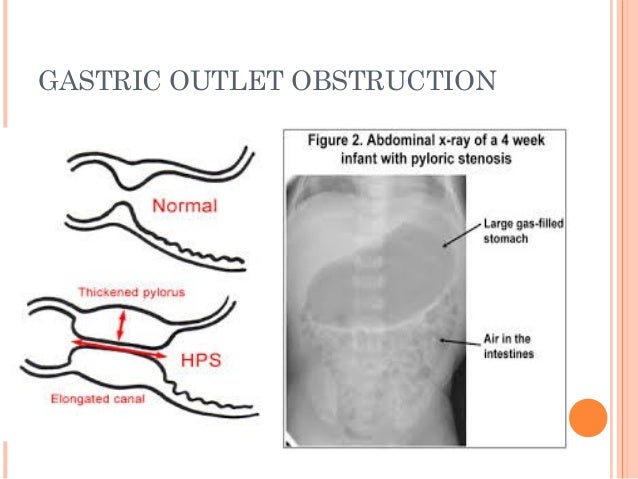 Gi radiology mbbs final