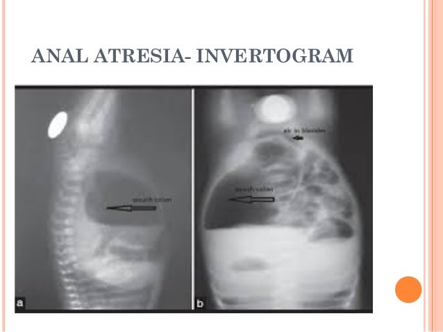 Gi radiology mbbs final